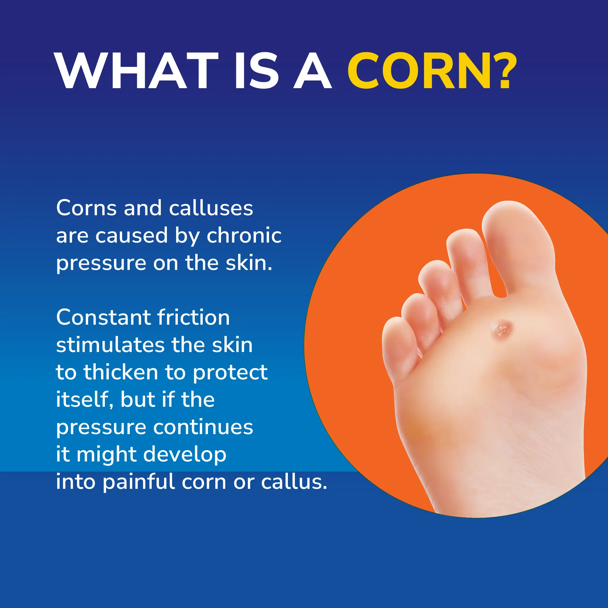 Corn Complete Removal Pen - Dr. Scholl's™ UK