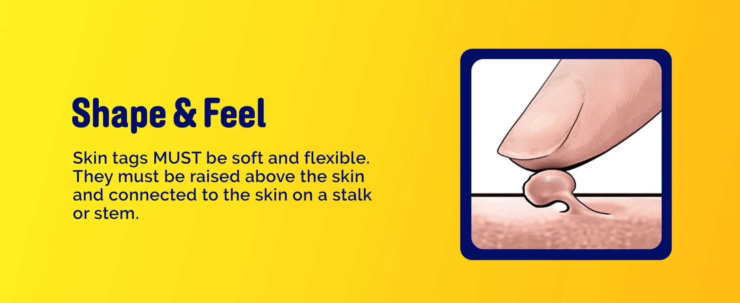 Freeze Away™ Skin Tag Remover - Dr. Scholl's™ UK