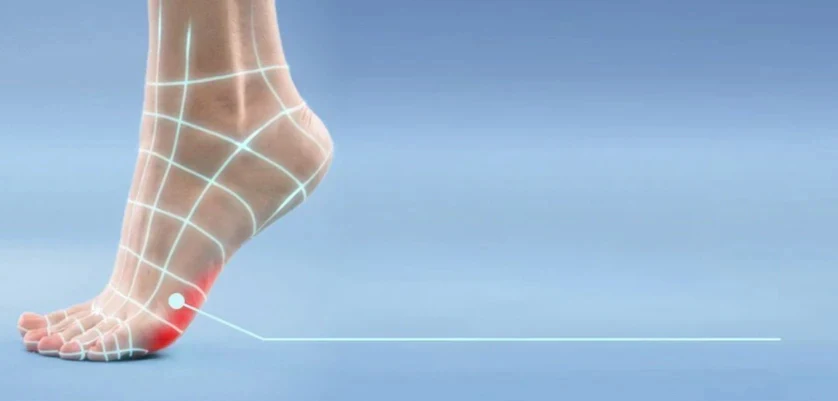 Ball of foot pain - Dr. Scholl's™ UK